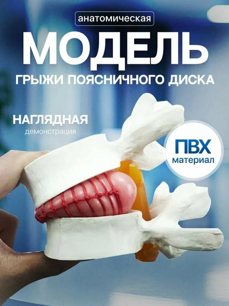 Анатомическая модель позвоночника, грыжа межпозвоночного диска. Масштаб 1: 1,5i，（Рекомендуемые качественные продукты）