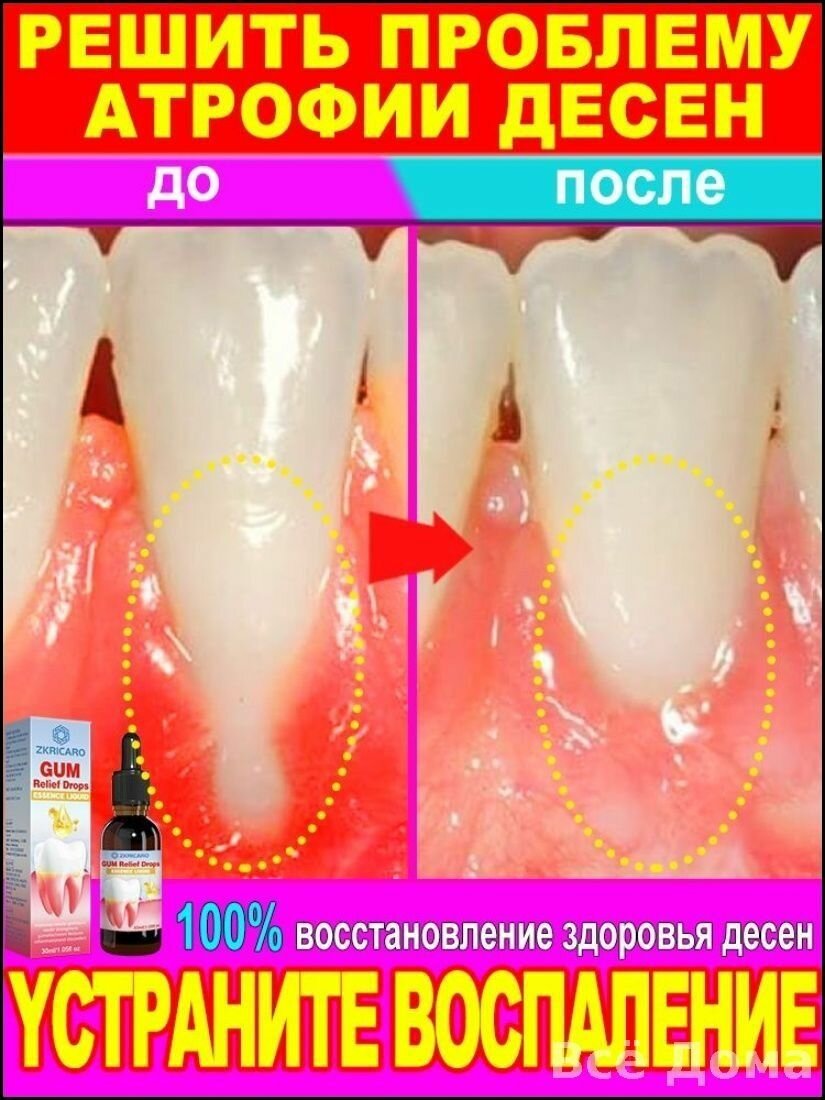 Эксклюзивный гель для восстановления и укрепления поврежденных десен.