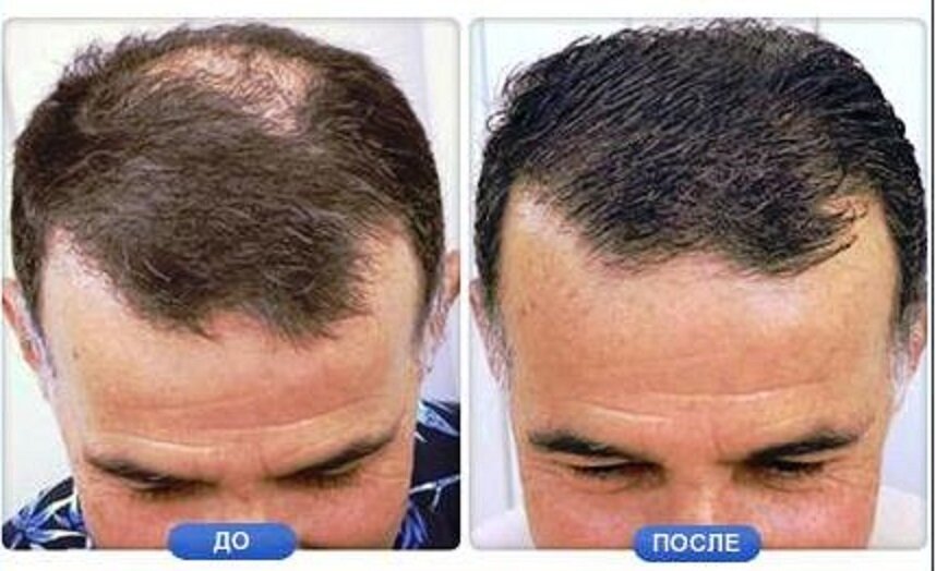 DermMatch/Пудра-загуститель для волос , Light Brown (светло-коричневый), 40 гр — фото 1