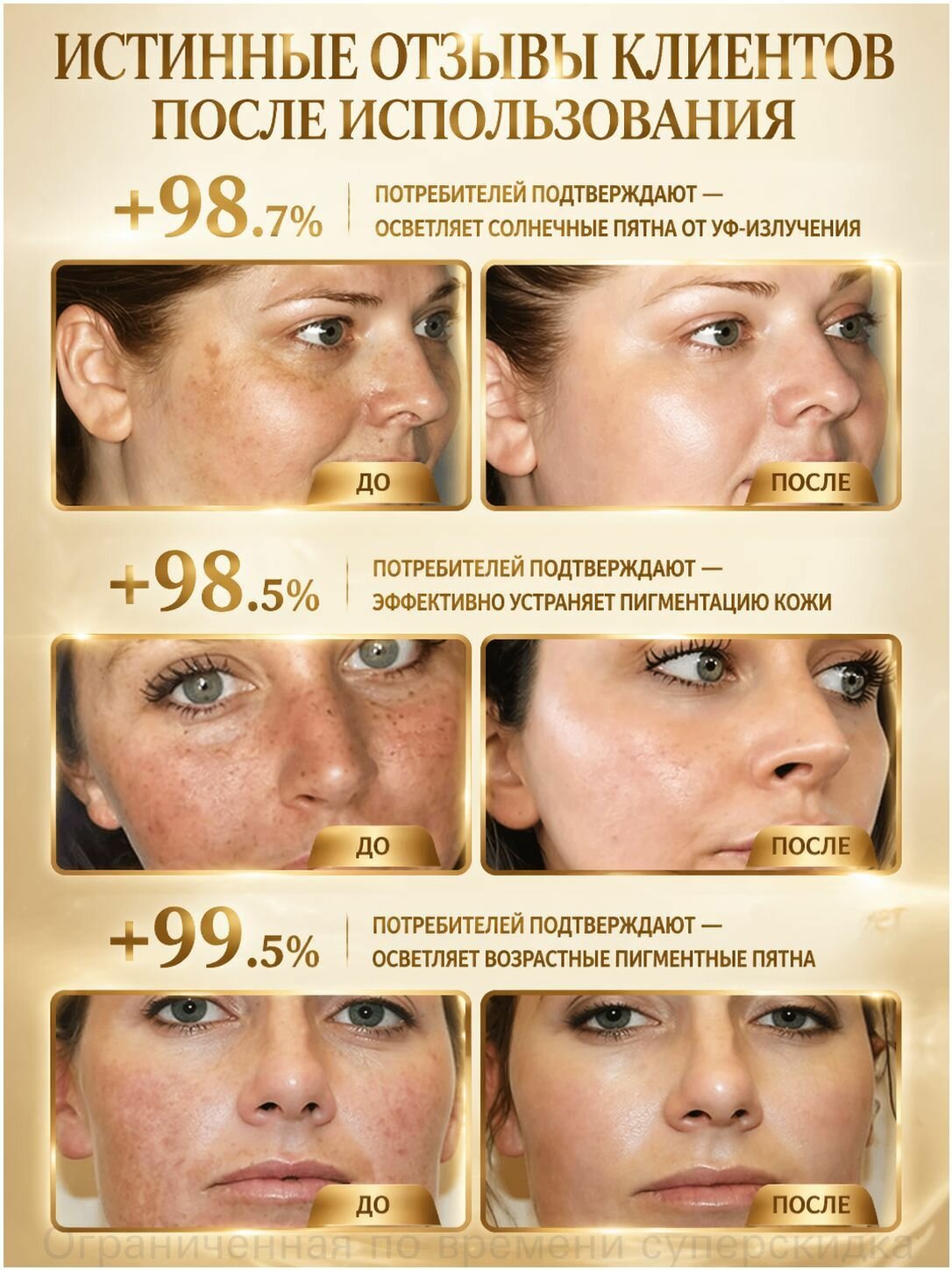 Крем DODOYURI для осветления, 50 г, применяемый против пигментации и возрастных изменений, популярный для возвращения белизны и гладкости кожи, удаляющий пятна. осветляющий крем для лица отбеливающий крем против пигментации