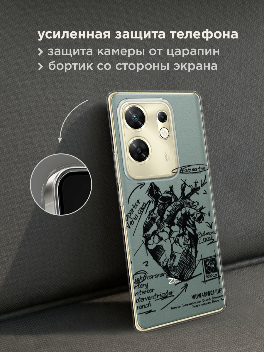 Чехол на Infinix Zero 30 4G / Инфиникс Зеро 30 4G с принтом "Анатомическое сердце 2", прозрачный — фото 1