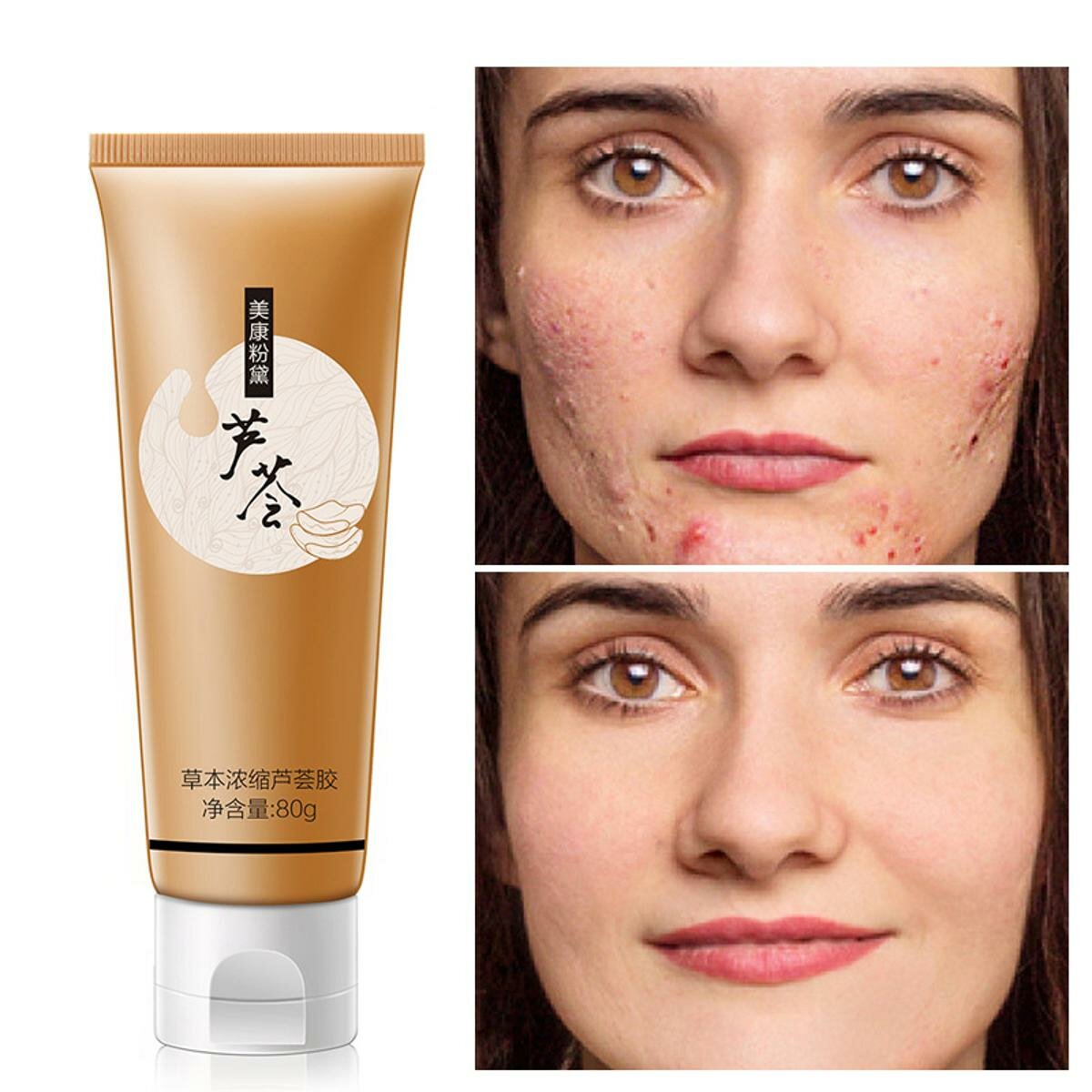 Meikaining Aloe Vera Gel - Дневной крем - Против морщин и отбеливание - Контроль жирности и борьба с акне - Увлажняющий крем - 80 г