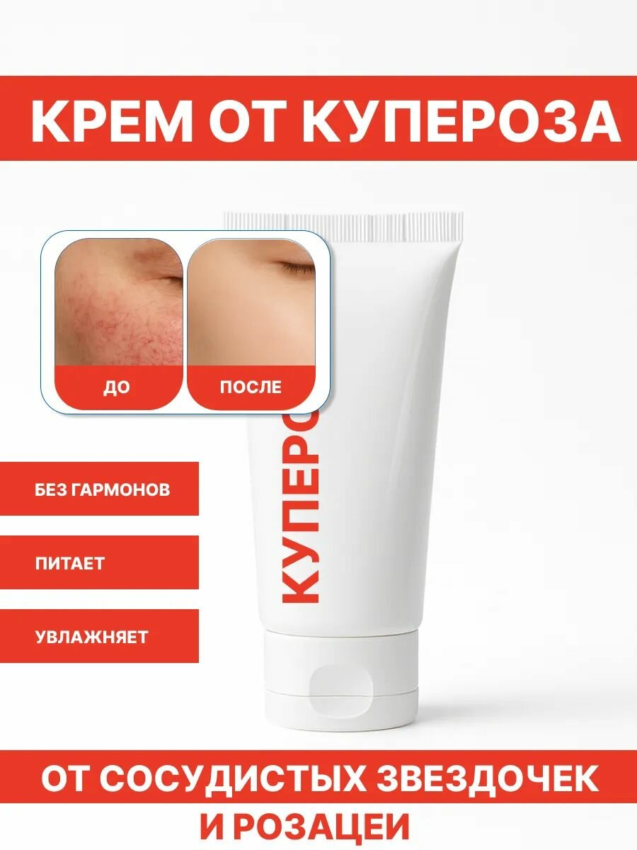 Крем от Купероф от купероза розацеа звездочек акне