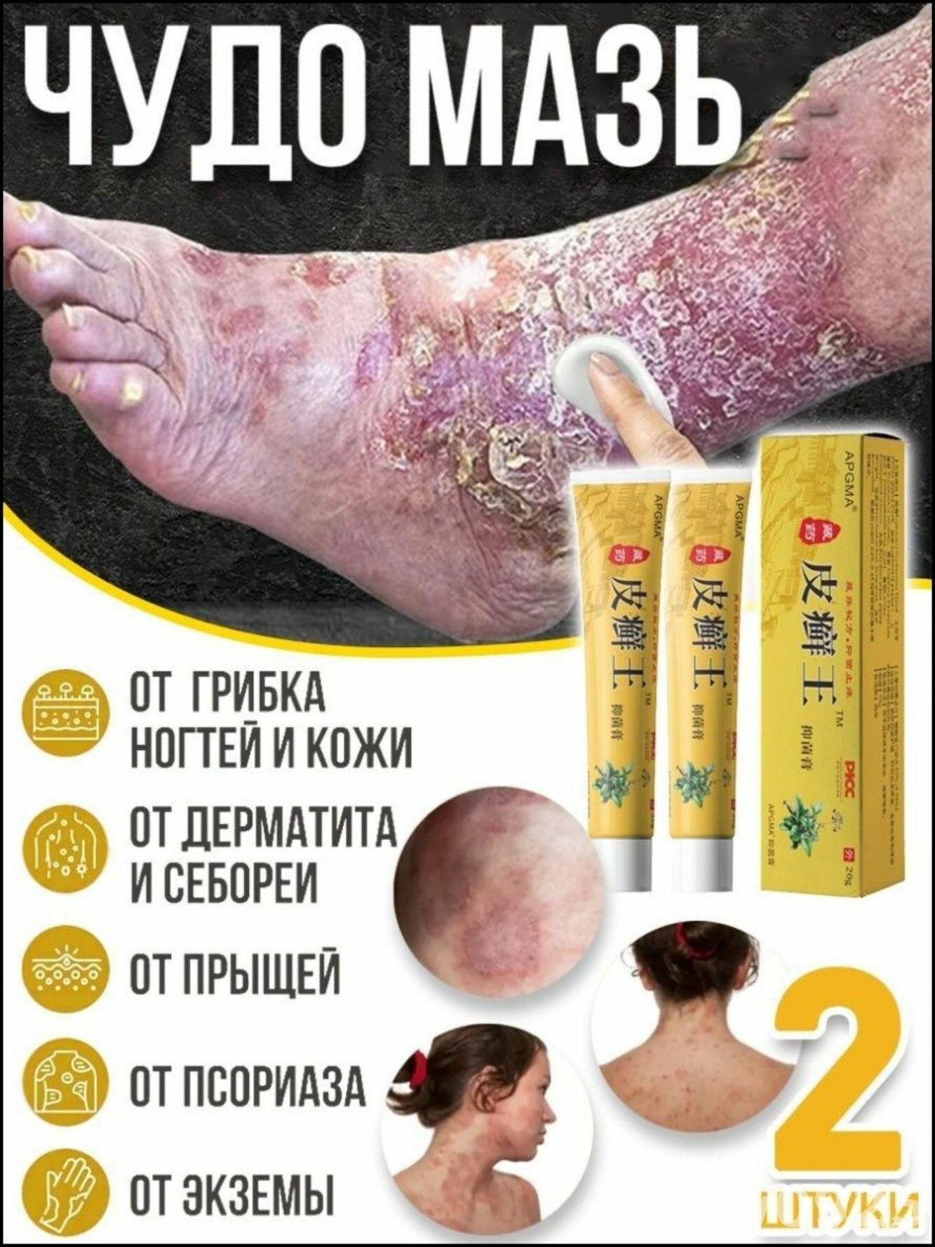 Инновационный крем бестселлер против псориаза экземы онихомикоза
