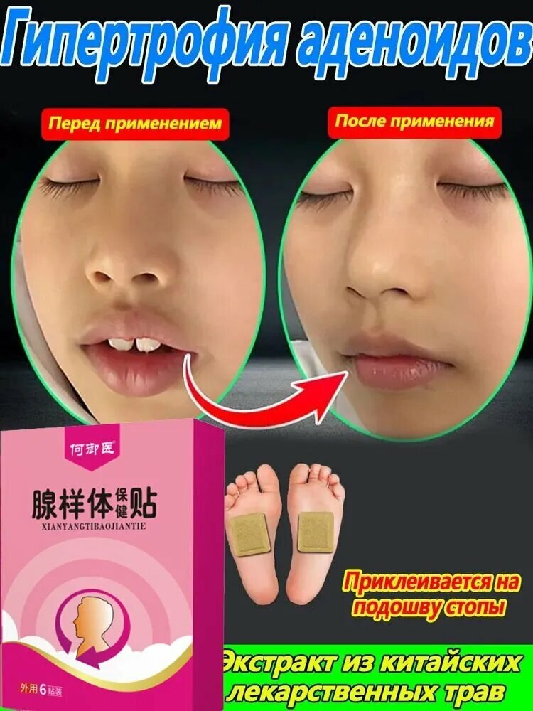 Пластырь традиционной китайской медицины от гипертрофии аденоидов Xiuyishu для коррекции детского лица, 1 коробка