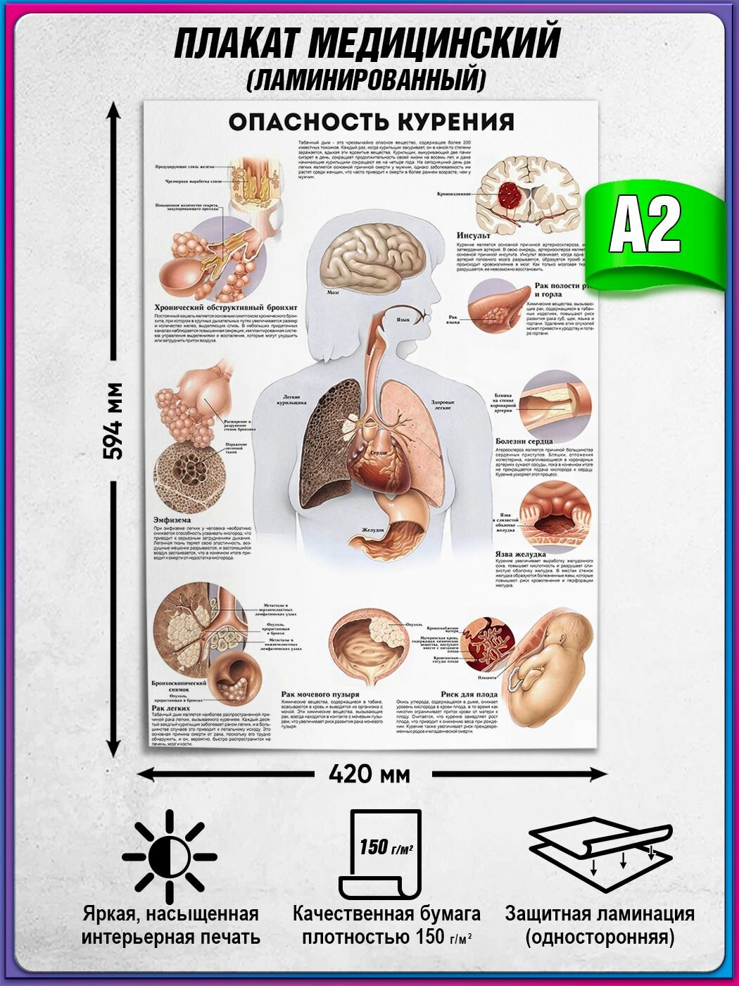 Информационный медицинский плакат "Опасность курения" / ламинированный / Формат А2 (42х60 см.)