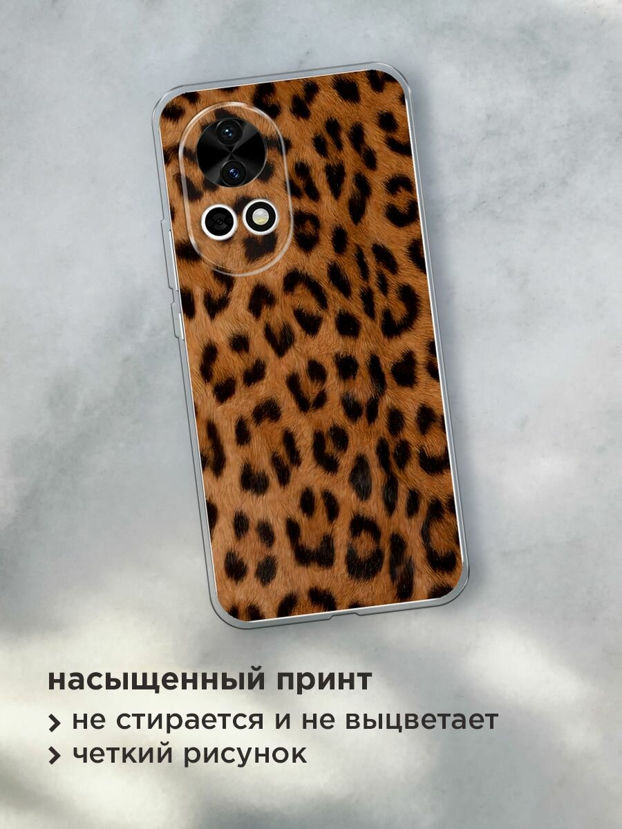 Чехол на Huawei Nova 12/Nova13 / Хуавей Нова 12/Нова 13 с принтом "Мех леопарда" — фото 1
