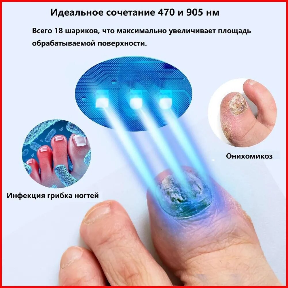 Лазерный инфракрасный аппарат для лечения множественного онихомикоза ногтей, эффективный и безопасный домашнего использования