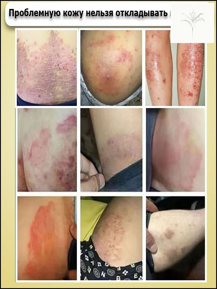 Крем для ухода за кожей