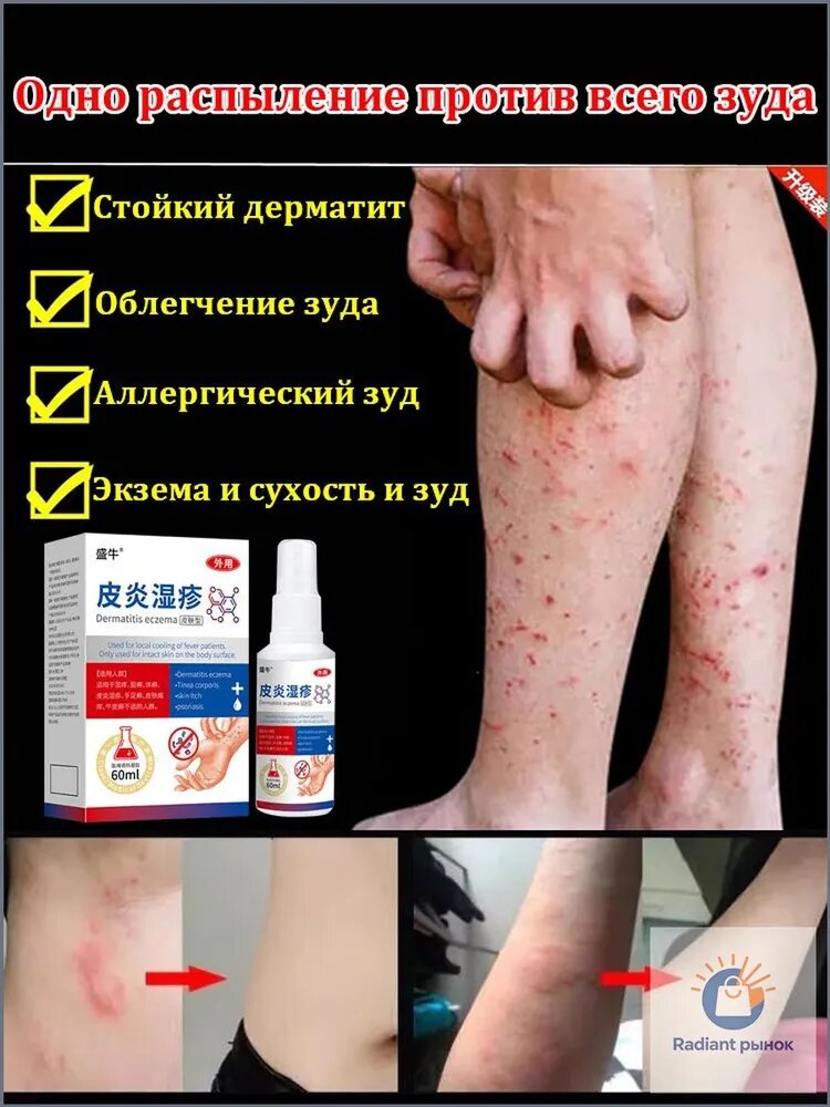 Спрей для ухода за кожей