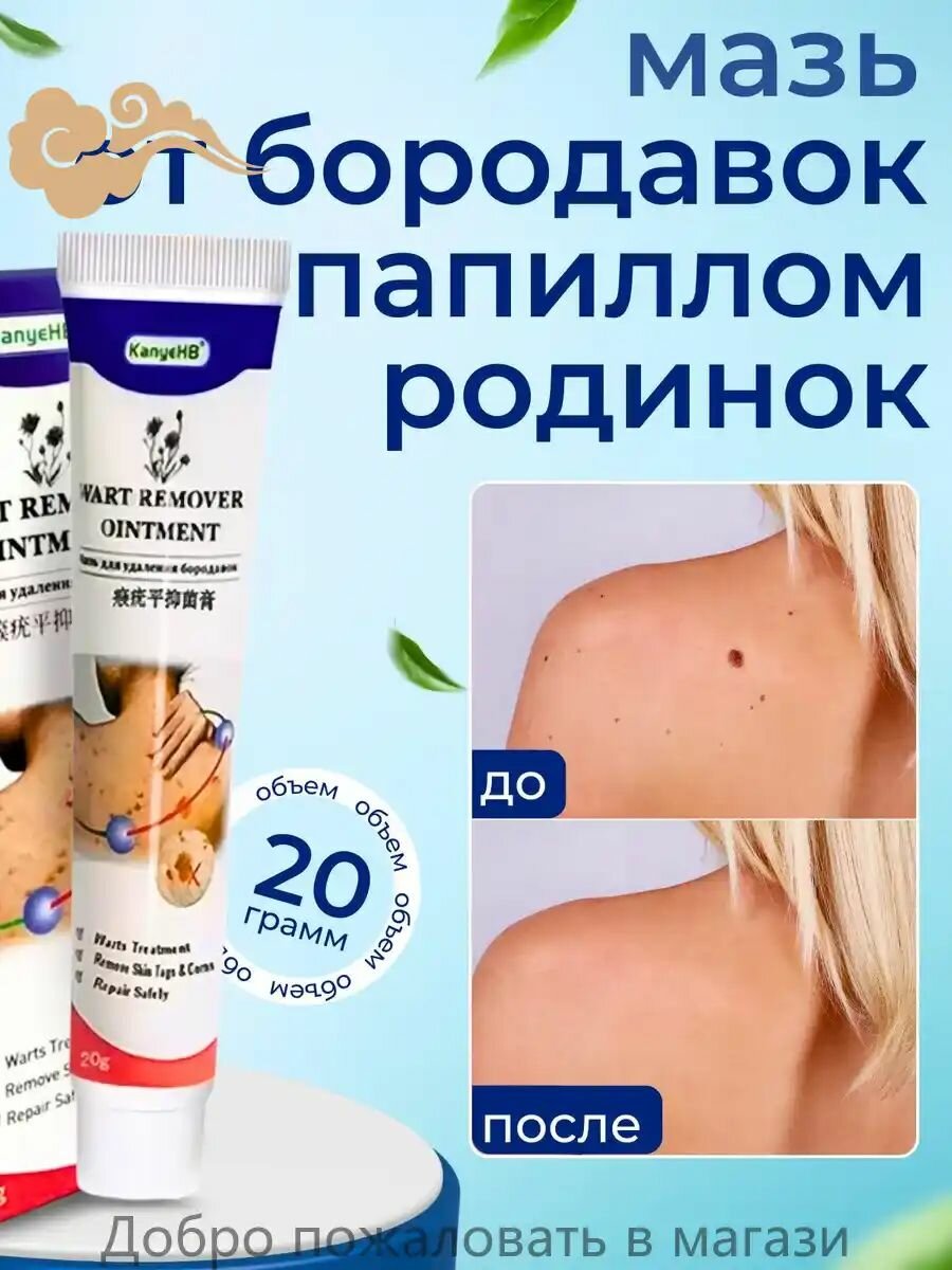 Мазь для удаления бородавок, папиллом и родинок.