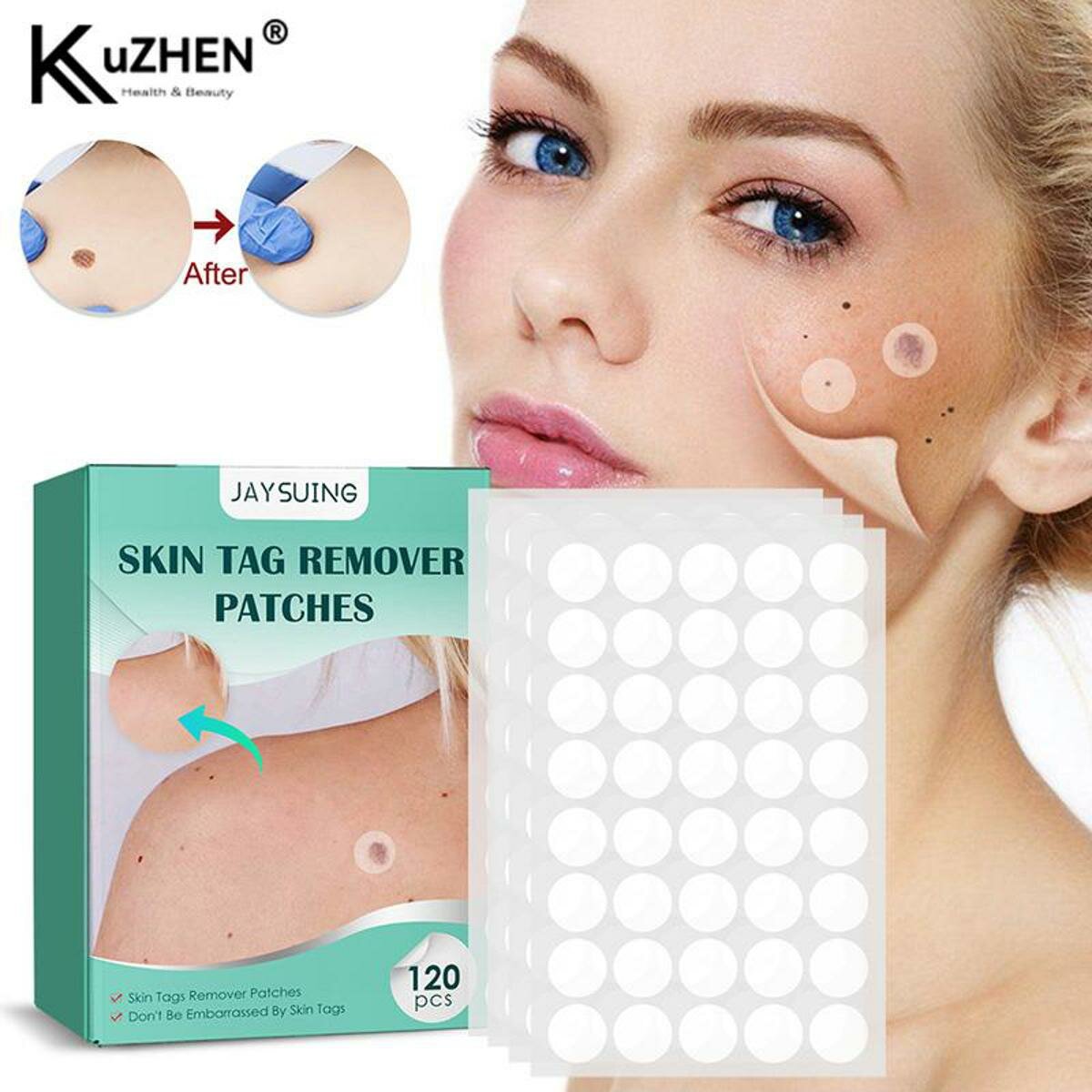 Невидимые наклейки для удаления бородавок, бирки для кожи, крем для лечения прыщей, гидроколлоидный гель для ног, кукурузный пластырь, прыщи, бородавки