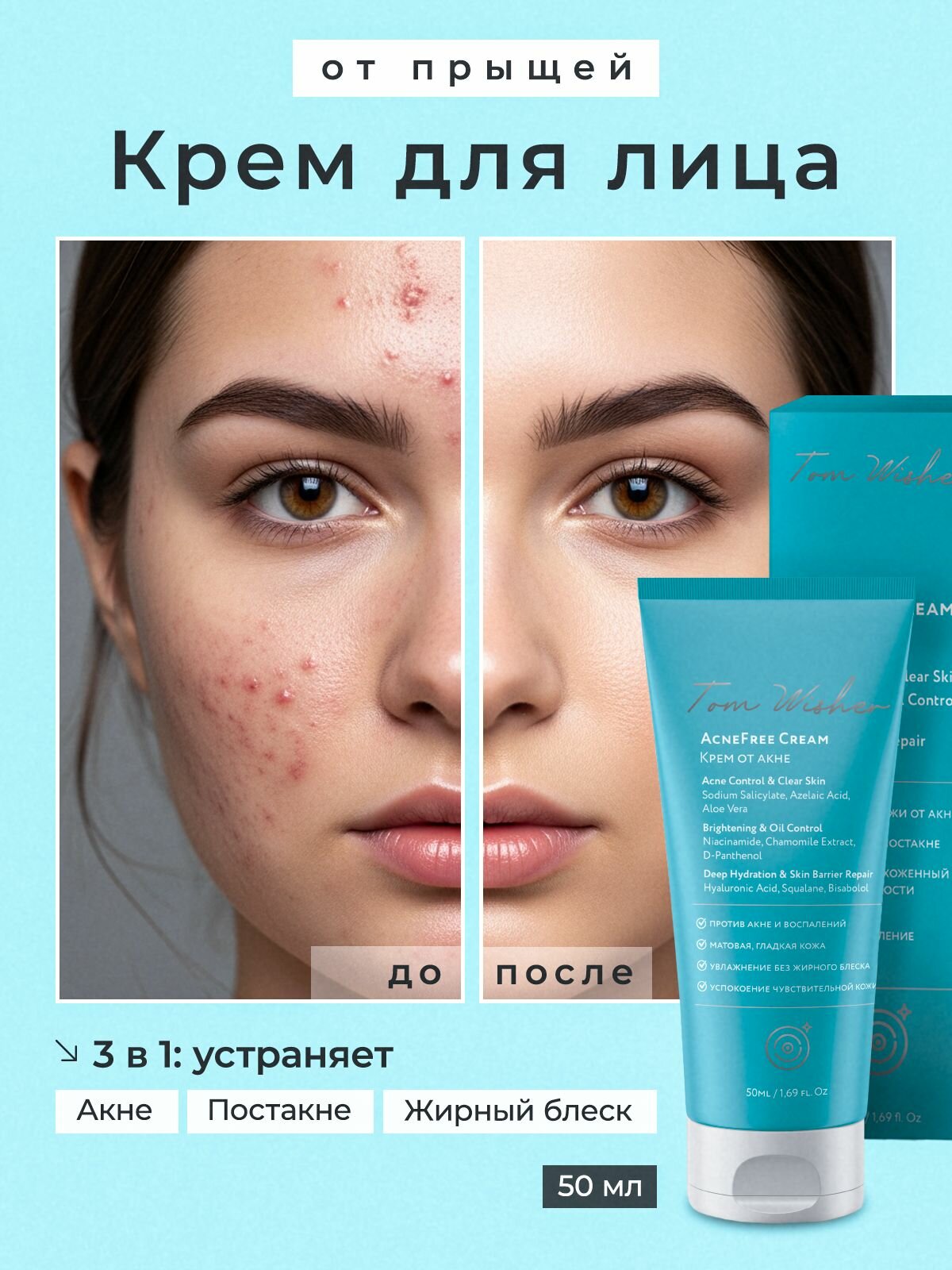 От прыщей крем для лица от акне от воспалений с азелаиновой кислотой Tom Wisher