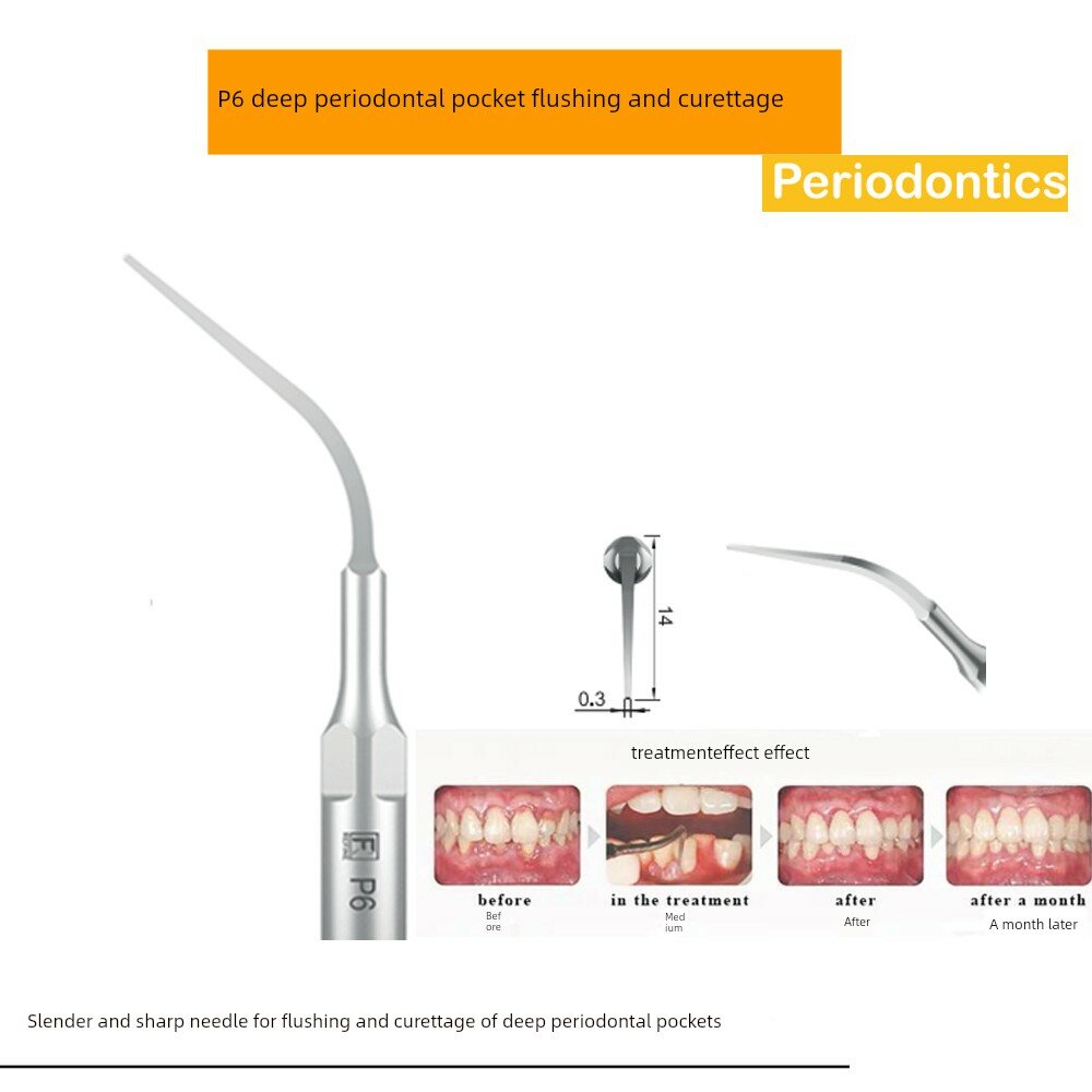 Универсальный ультразвуковой насадка-скалер EMS для удаления поддесневого зубного камня, насадка для