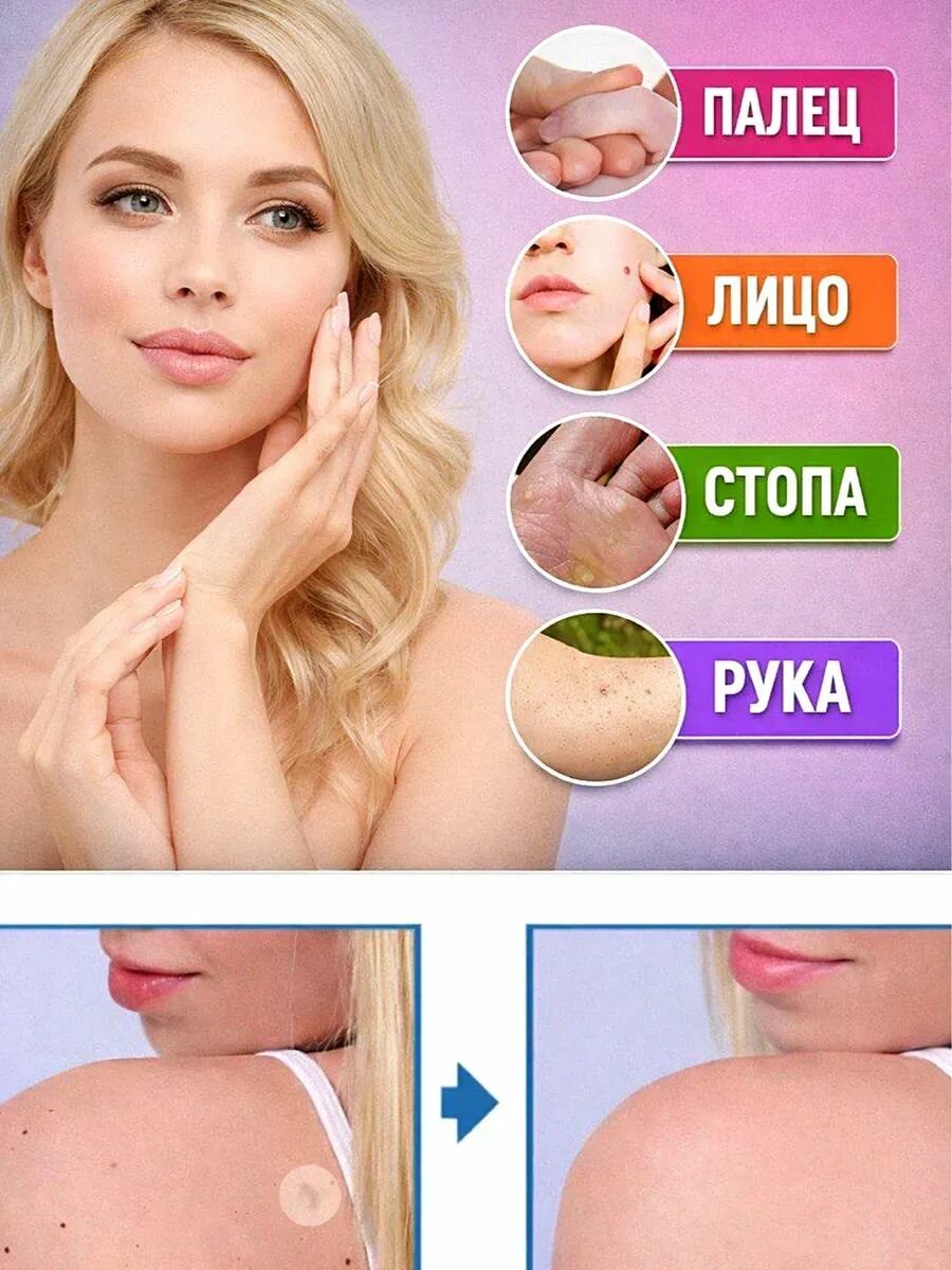 Патчи-точки — фото 1