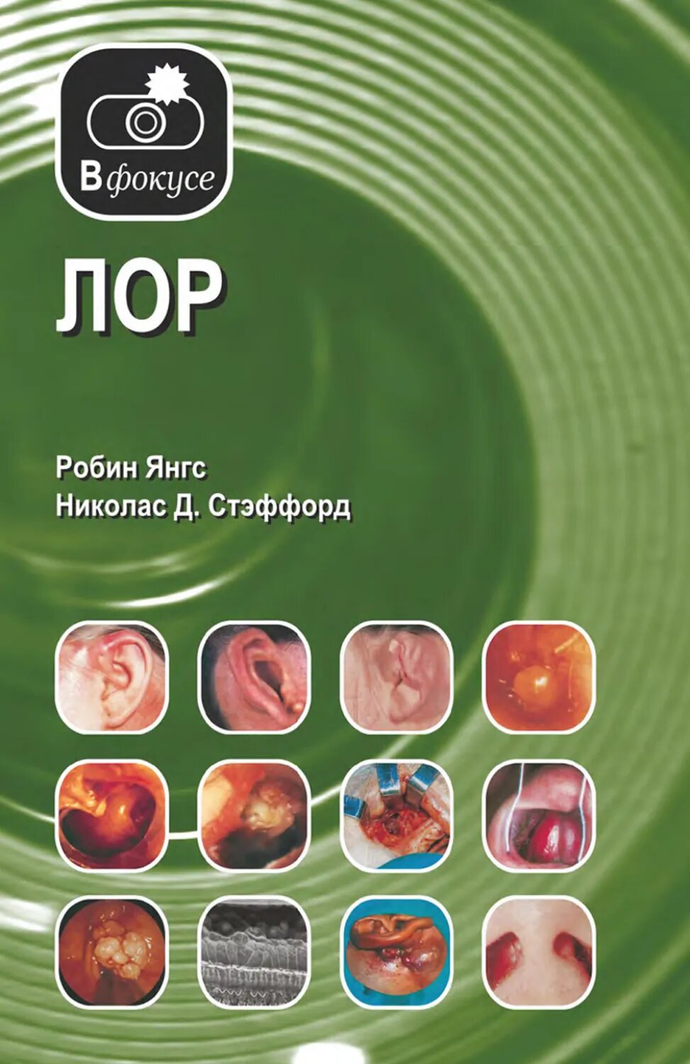 ЛОР. Атлас – справочник [Цифровая книга]