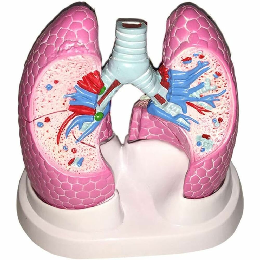 Модель легкого