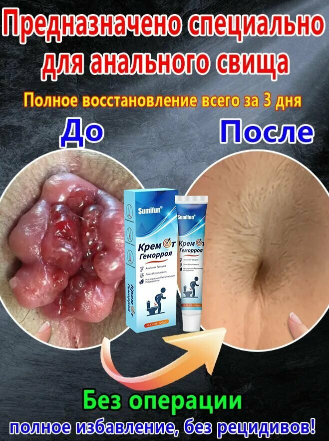 Мазь от геморроя Sumifun, быстрое снятие зуда и отека, лечение трещин и шишек