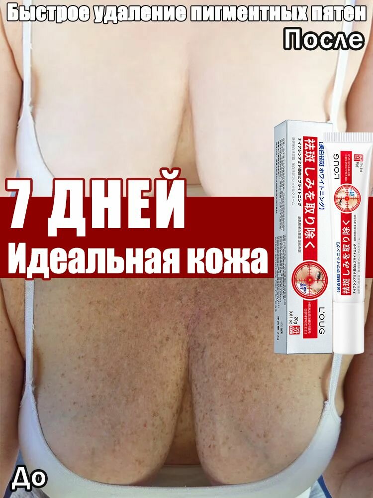 Отбеливающий крем для лица, от пигментации и веснушек, для удаления мелазмы, веснушек, возрастных и других видов пятен 20 г