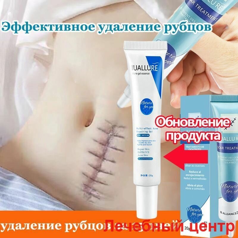 Гель для удаления рубцов 20 грамм используется для удаления следов хирургических вмешательств, травм, кесарева сечения, ожогов, угревой сыпи, пролиферативных рубцов и т. д.