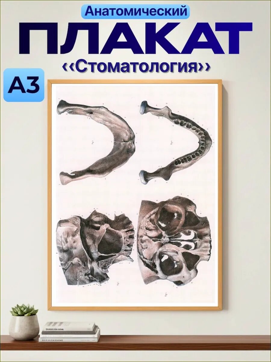 Постер медицинский, челюсть, стоматология, А3 анатомия, хирургия
