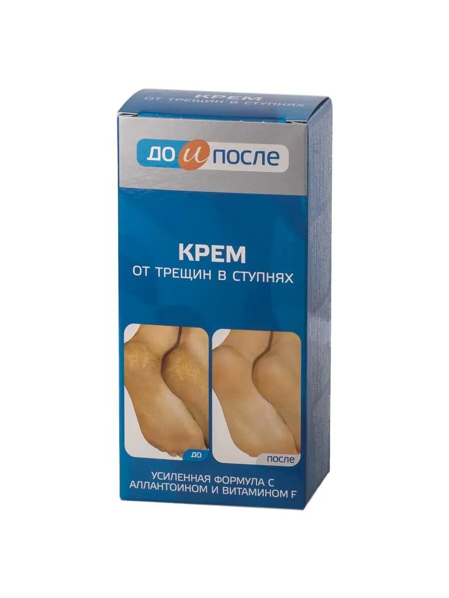 До и После Крем от трещин в ступнях, крем для ног, 150 мл, 1