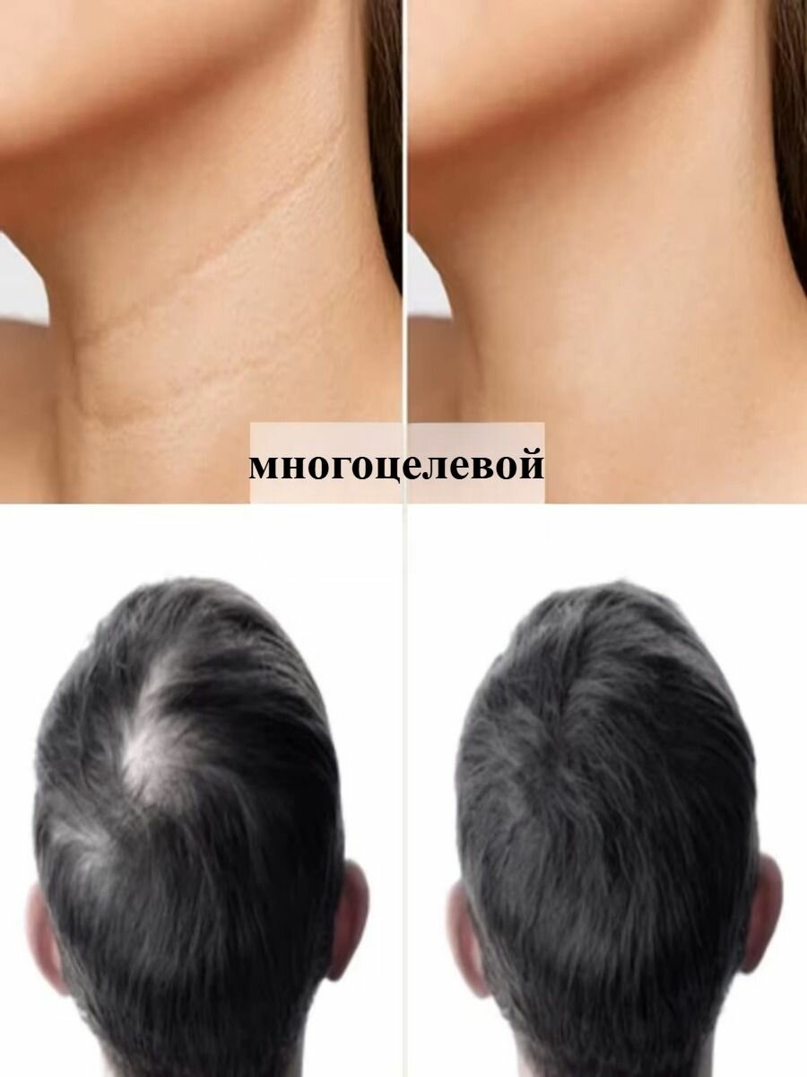 Стимулятор игольчатый "Колесо вартенберга" для сосков 18+