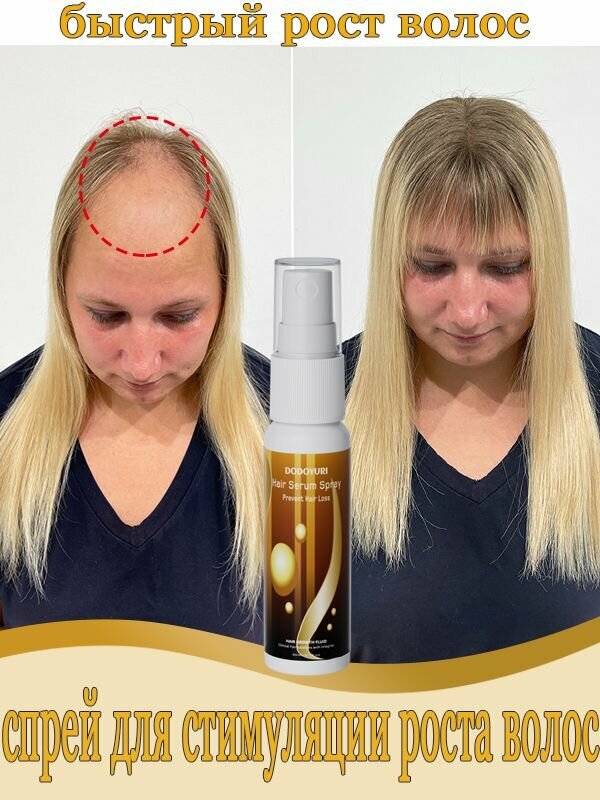 DODOYURI Спрей для роста волос и от выпадения волос средство 30мл комплексом витаминов, аргинином и кератином, профессиональный