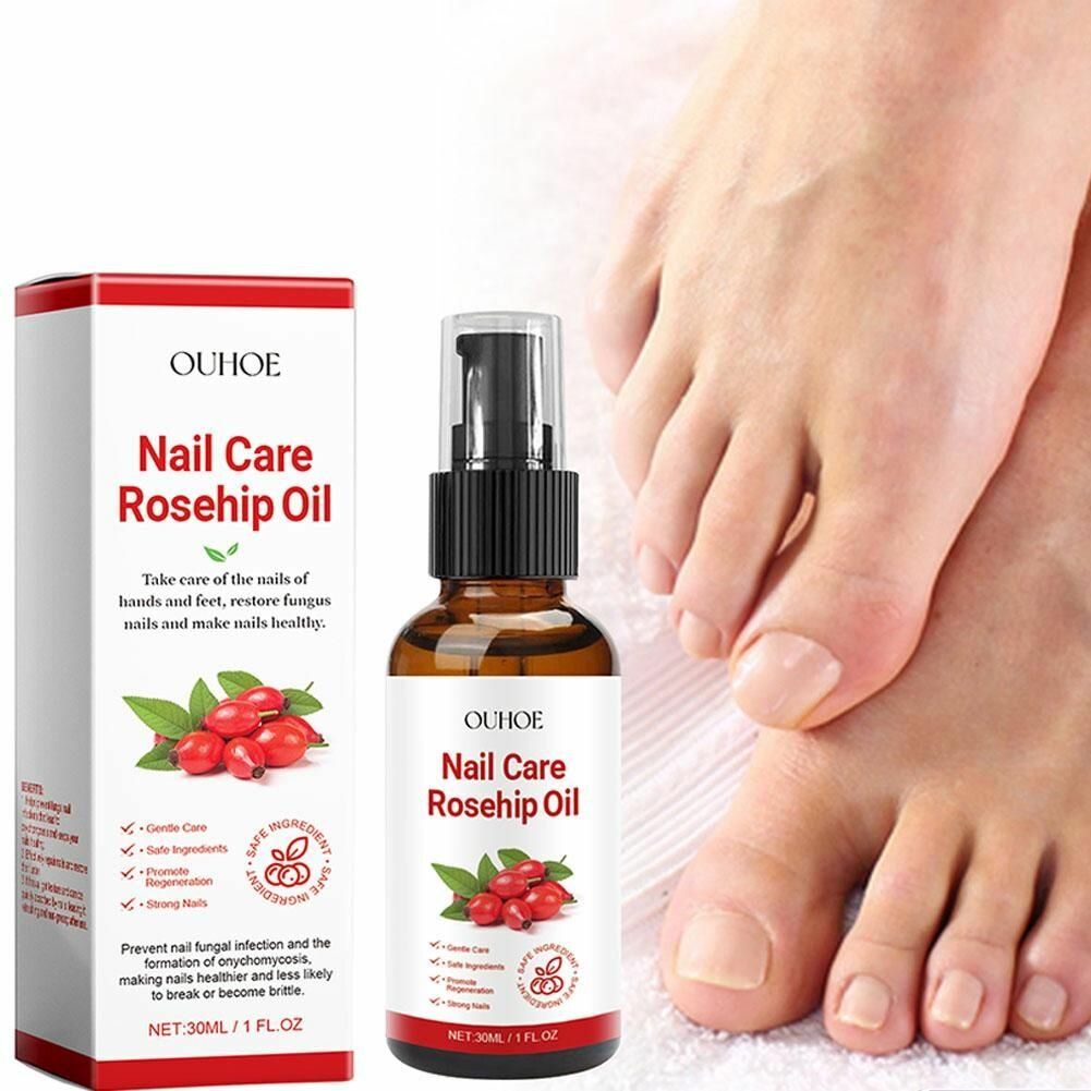 30ml Капли для восстановления ногтей на ногах, Подходит для лечения онихомикоза