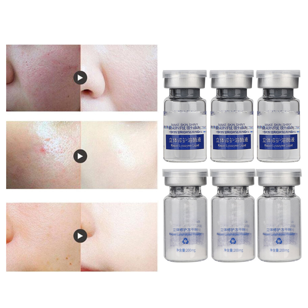 Сыворотка Для Лица: Увлажняющая И Восстанавливающая 3 Набора - Гипоаллергенная Формула Без Вредных Добавок Для Чувствительной Кожи - Уменьшает Поры И Следы От Прыщей