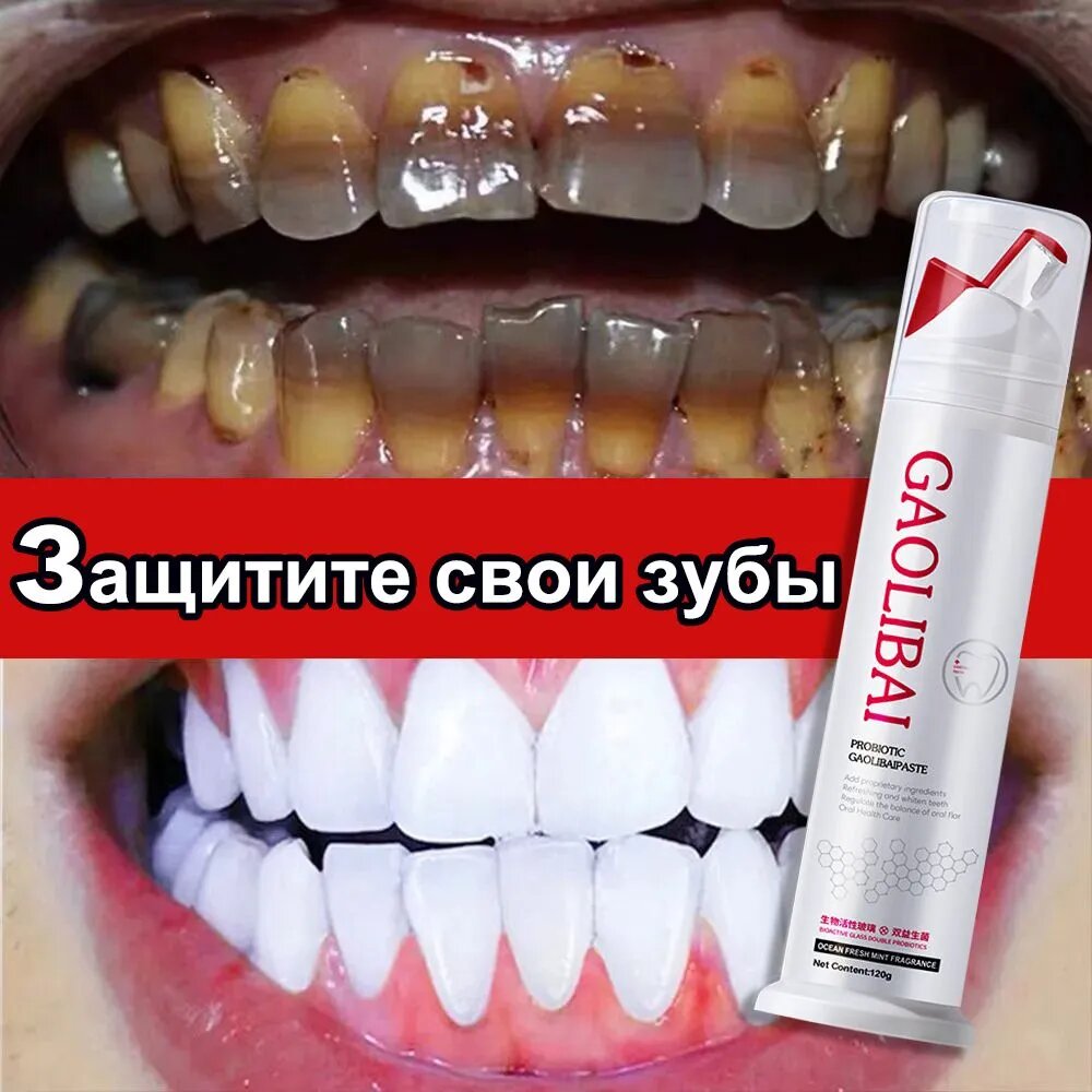 Пробиотики Зубная паста отбеливающая, от табачного, чайного, кофейного налета и зубного камня, для чувствительных зубов, профилактика заболевания десен для эффективного отбеливания зубов 120 г