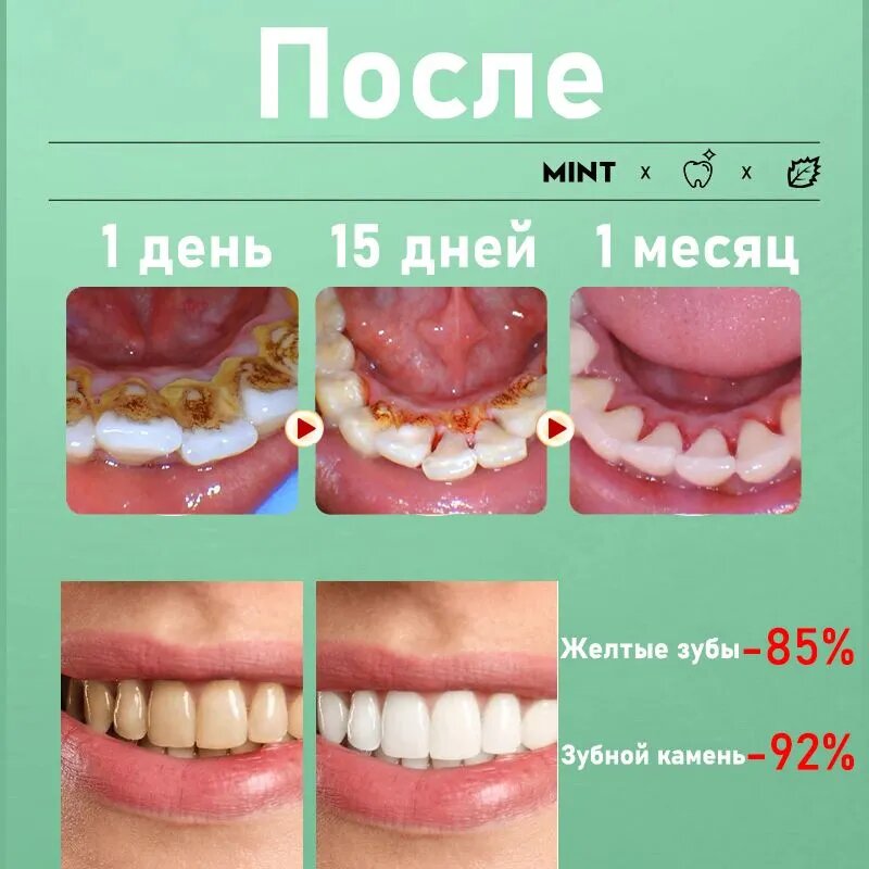 Зубная паста — фото 1