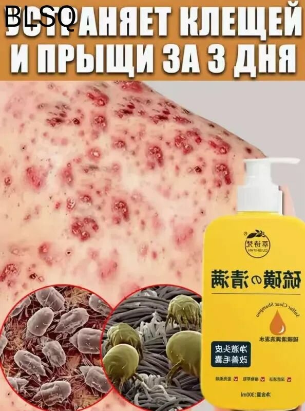 Гель для душа с серой против клещей Зудящая кожа, удаляет прыщи, красные пятна, прыщи и клещей на спине 300 мл