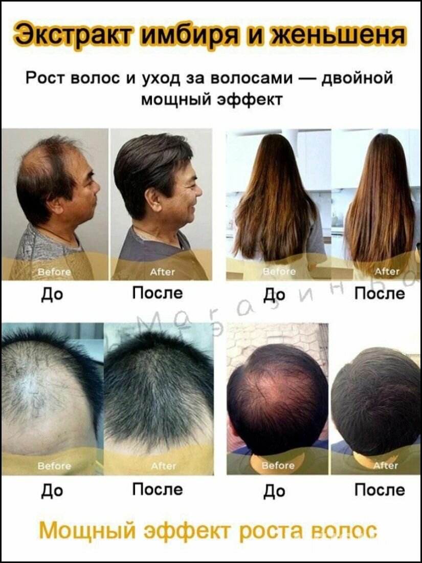 Шампунь для волос — фото 1