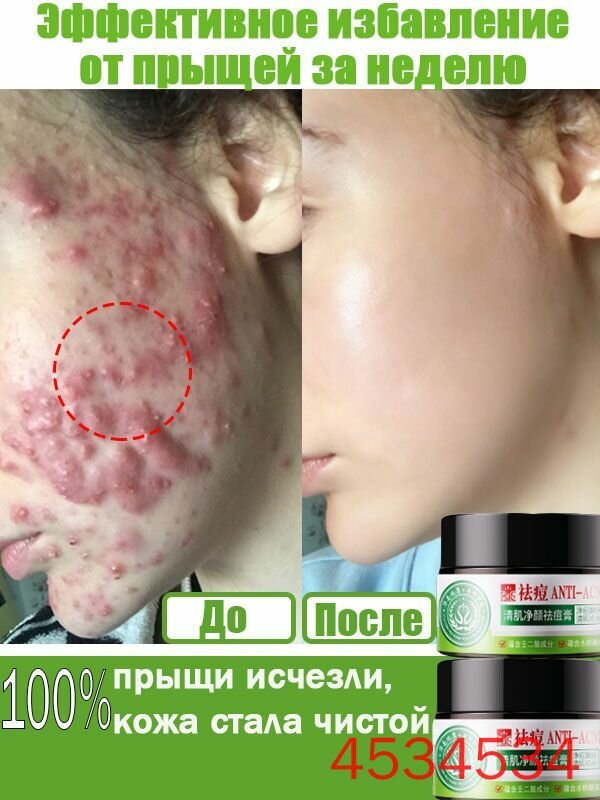 Салициловая мазь от прыщей, направленная на акне и угри, эффективно борется с воспалениями, прыщами и последствиями акне, подходит подросткам и проблемной коже, 60 г.