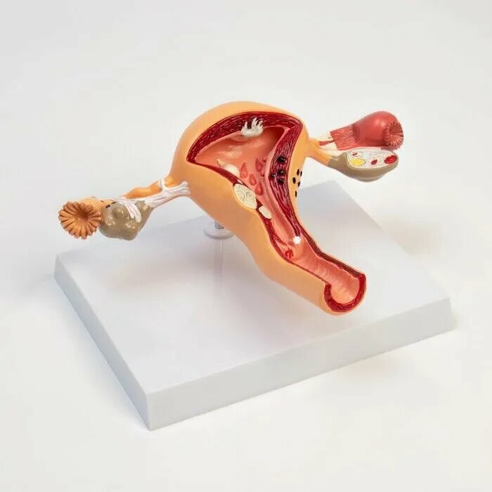 Анатомическая модель, Макет "Органы матки, патологии" 24х12х20см
