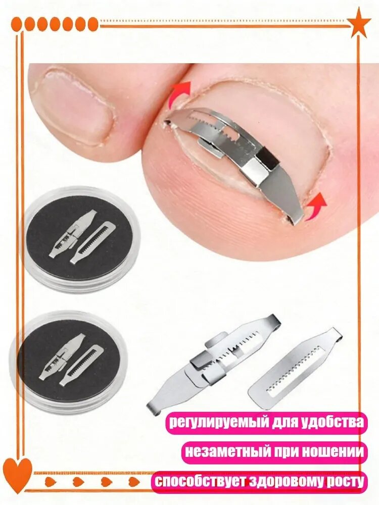 Стальной корректор вросшего ногтя, 2 х пряжки для вросших ногтей на ногах