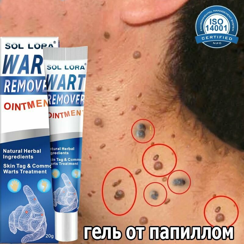 Гель от папиллом / Чистотел, от бородавок, крем от прыщей, крем для тела, для рук, для ног / 20 мл
