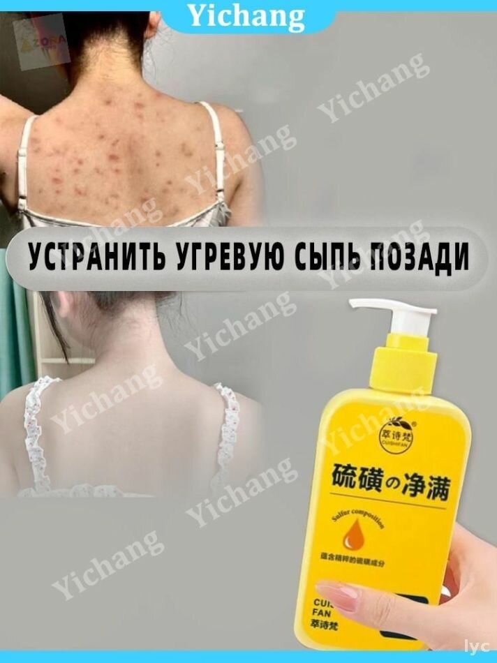 Эксклюзивный гель для душа 300 мл против прыщей и клещей, обеспечивающий глубокую стерилизацию для всех типов кожи