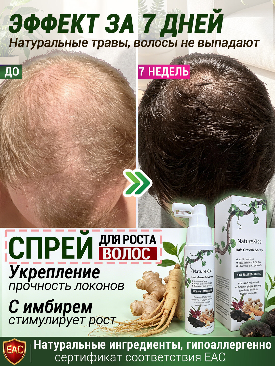 Спрей от выпадения и для роста волос женский 60 мл, с экстрактом имбиря, останавливает выпадение стимулирует рост укрепляет корни