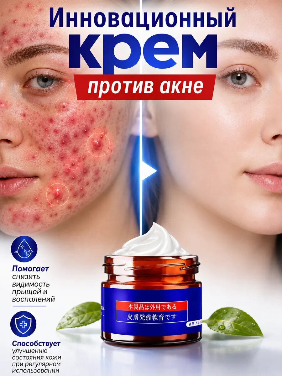 Базирон ас от прыщей на лице крем аналог