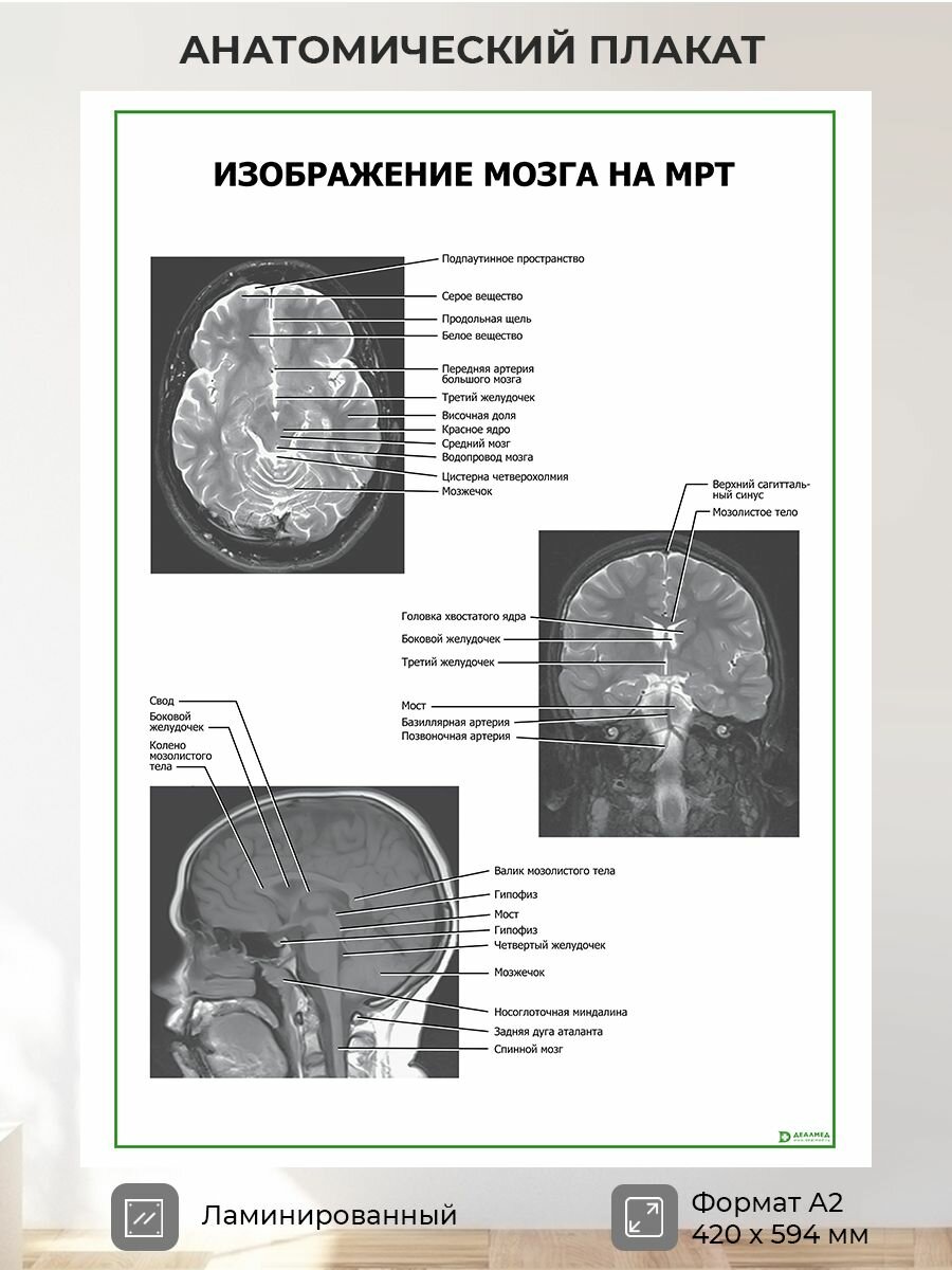 Обучающий медицинский плакат ламинированный формат А2 Изображение мозга на МРТ