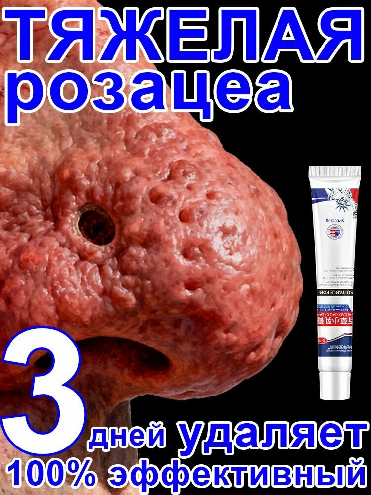 Крем от покраснений, розацеа, купероза и сосудистых звездочек для точечного , 20мл