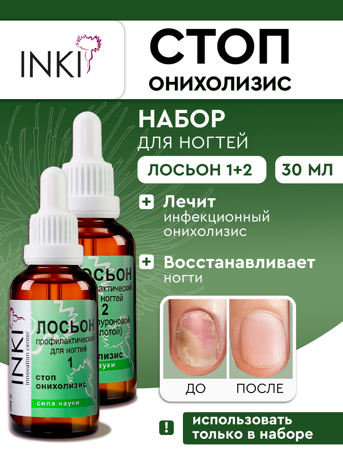 Набор для ухода за ногтями "Стоп Онихолизис" от INKI лосьоны