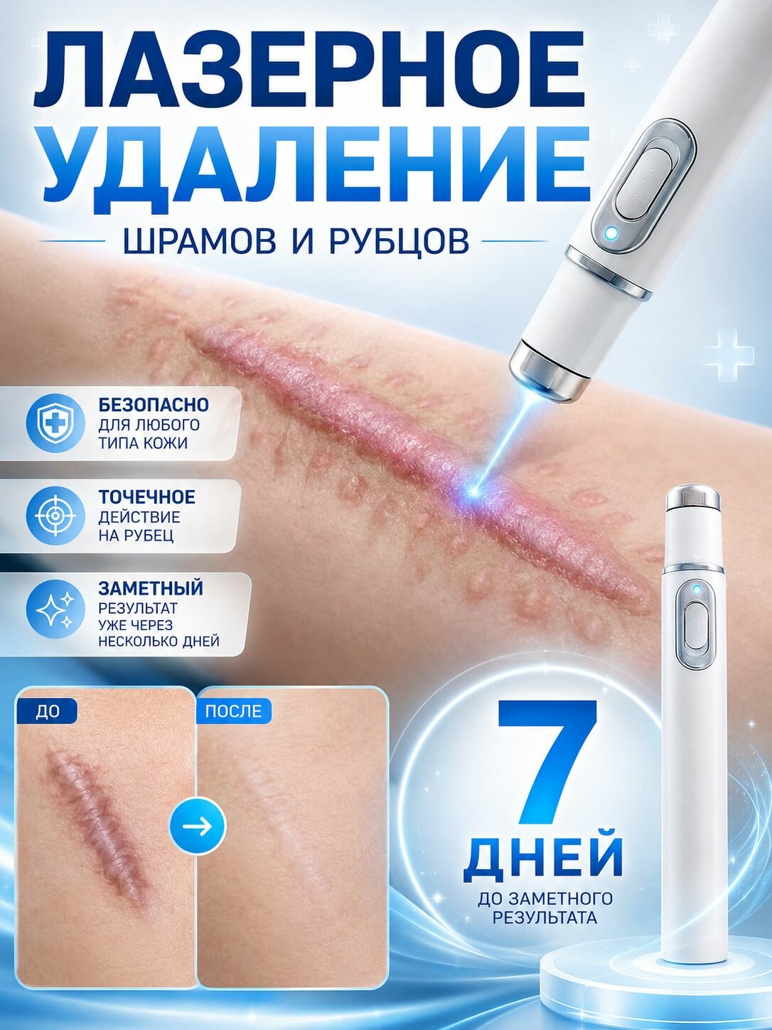 Лазерная ручка для удаления шрамов, удаляет шрамы, родинки, ожоги, растяжки, следы ожирения, лечит послеоперационные шрамы, предотвращает образование рубцов, восстанавливает кожу.1 упаковка. профилактика рубцов восстановление кожи лечение ш