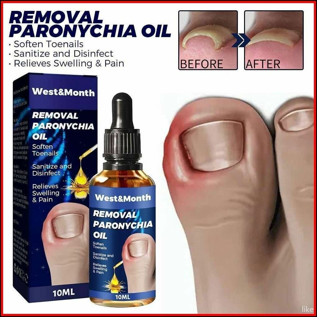 20г Масло от вросших ногтей, снимает паронихию, для ухода за ногтями на ногах