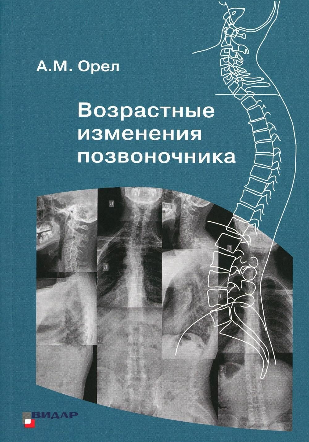Возрастные изменения позвоночника. Орел А. М.