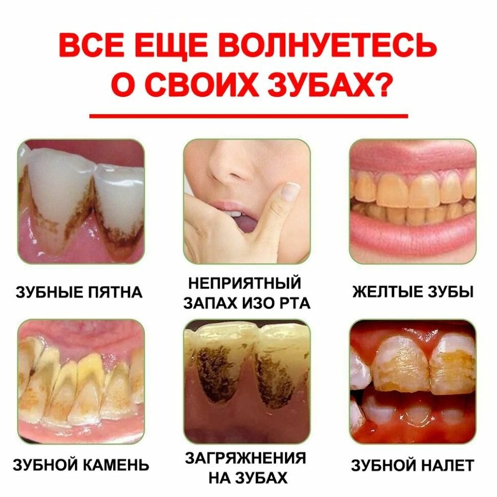 Эксклюзивная черная зубная паста GAOLIBAI 120 г один для осветления эмали, эффективно удаляющая налет от кофе, чая, табака и зубного камень, без фтора и парабенов