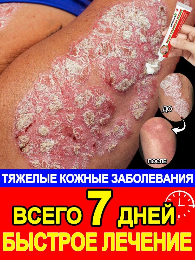 Крем для ухода за кожей