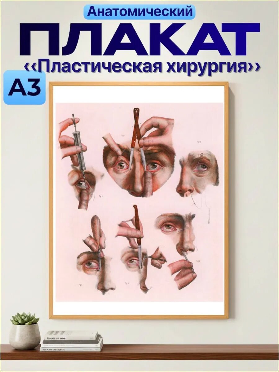 Постер медицинский, пластическая хирургия, пластика, А3 анатомия, хирургия